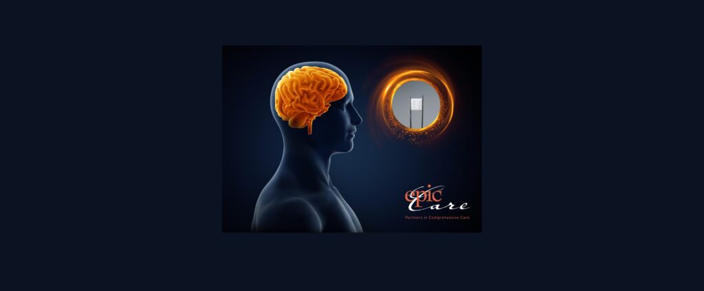 Innovation Ignited For Brain Tumor Therapy - Epic Care